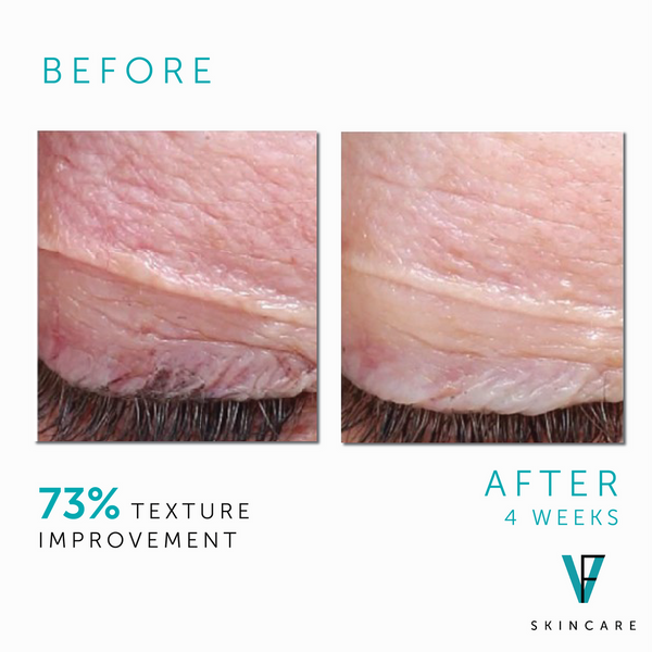 Eye/Lash Cream – Naturale Touch Store